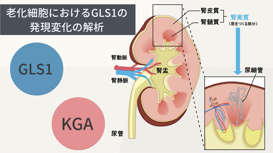 老化細胞を選択的に除去する「GLS1阻害剤」って何？ | 合同会社 Medivery（メディバリー）